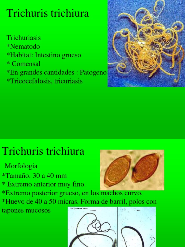 trichuris_trichiura