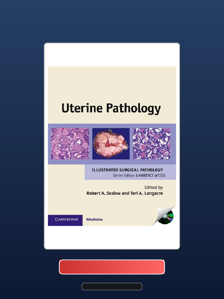 Complete Bundle Uterine Pathology Cambridge Illustrated Surgical ...