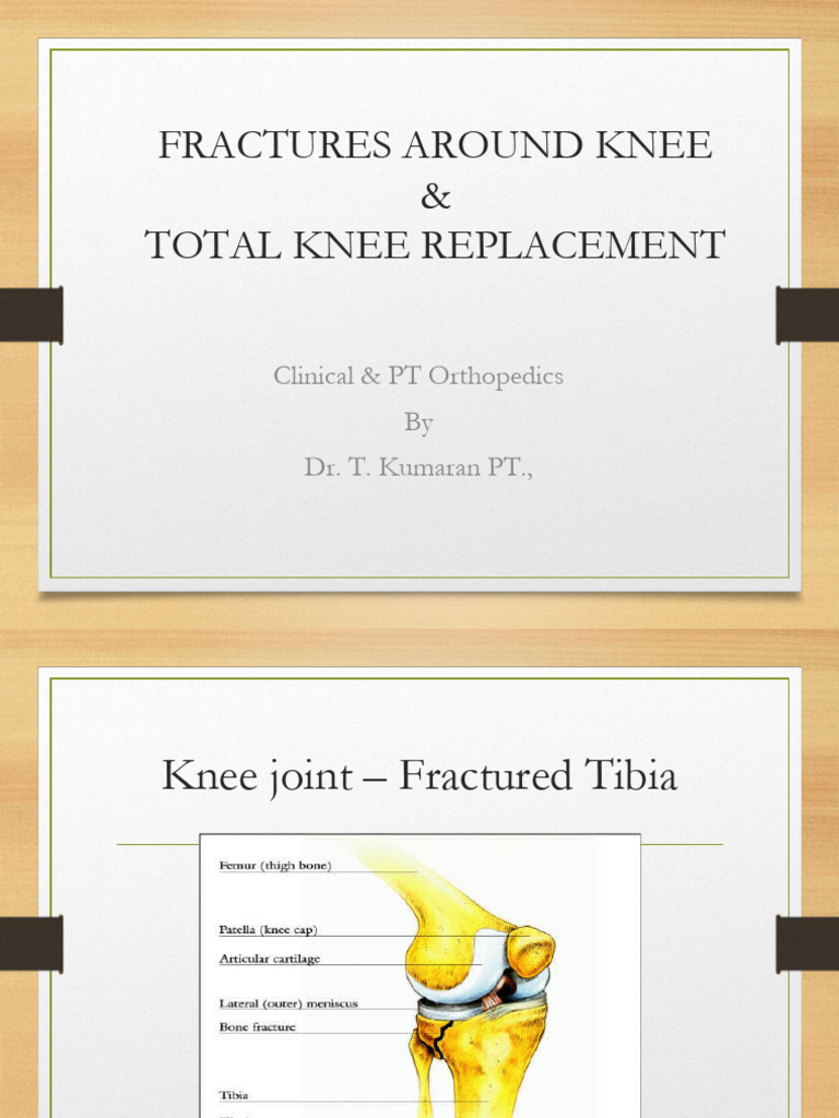 B10. Fractures Around KNEE and LEG | PDF | Knee | Joints
