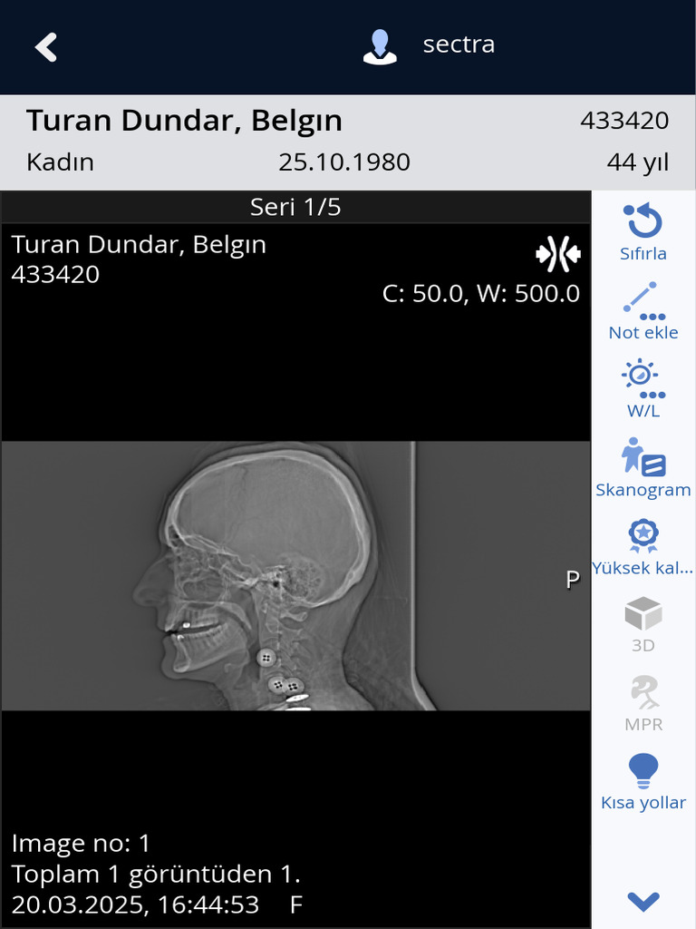 Sectra UniView | PDF