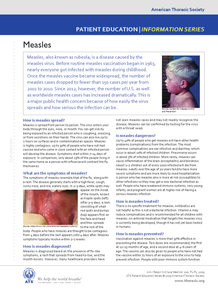 Keller Et Al 2019 Measles | PDF | Measles | Infection