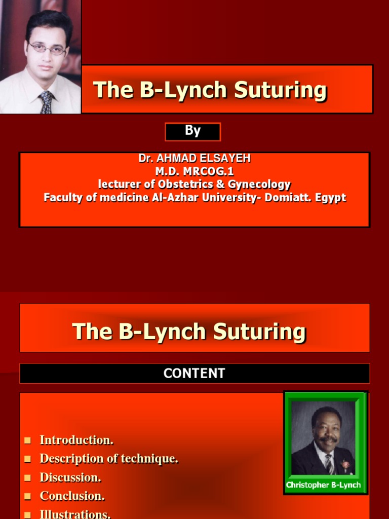 B Lynch Suturing | PDF | Uterus | Surgical Suture