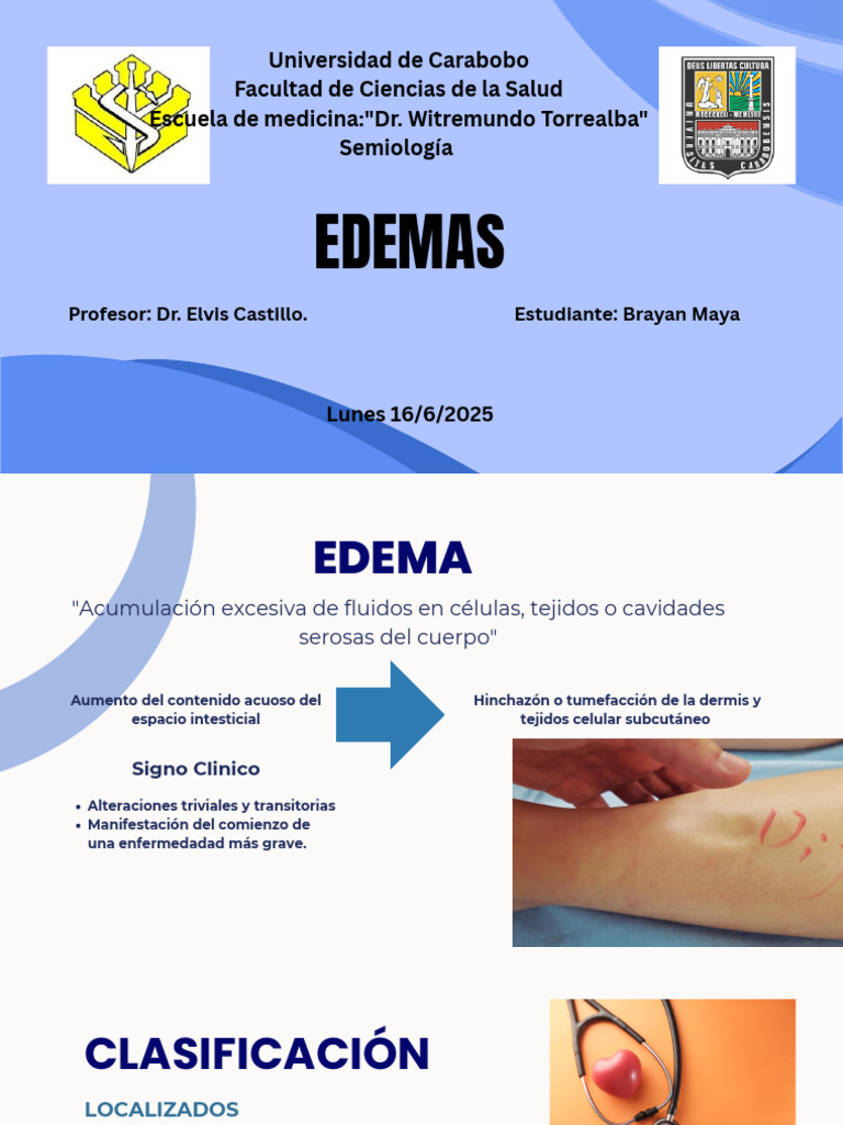 Edema: Causas, Clasificación y Diagnóstico | PDF | Edema | Fisiología