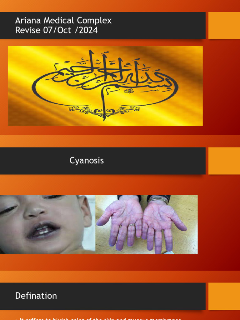 Understanding Cyanosis: Types and Causes | PDF