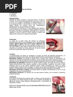 Tema 3. - Incisiones y Colgajos | PDF | Odontología | Biopsia
