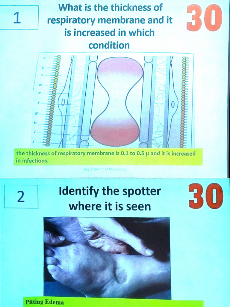 Physio Spotters | PDF