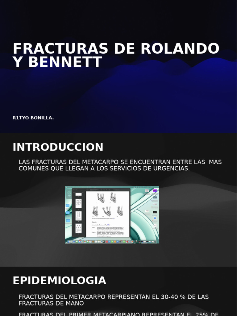 Bennett y Rolando Calles | PDF | Mano | Extremidades (anatomía)