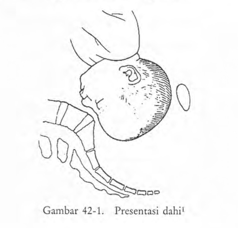 Presentasi Dahi | PDF