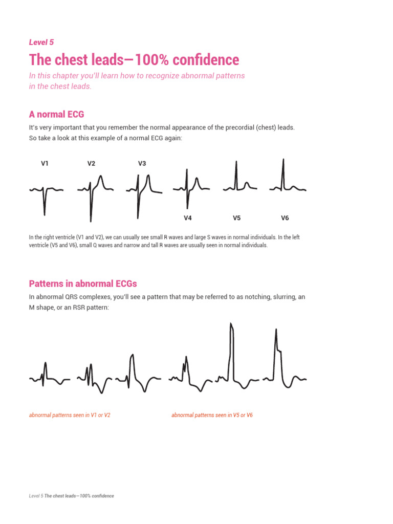 Abnormal Chest Lead ECG Patterns | PDF | Internal Medicine ...