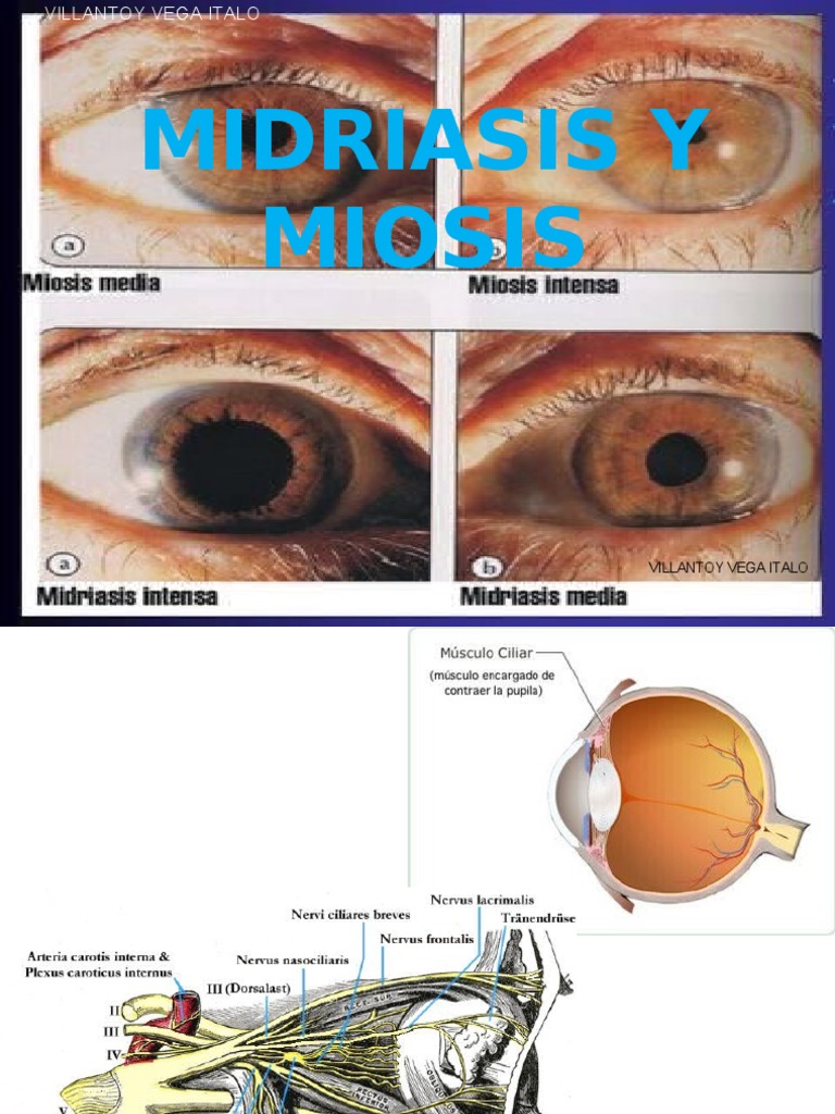 Midriasis y Miosis | Anatomía humana | Neuroanatomía