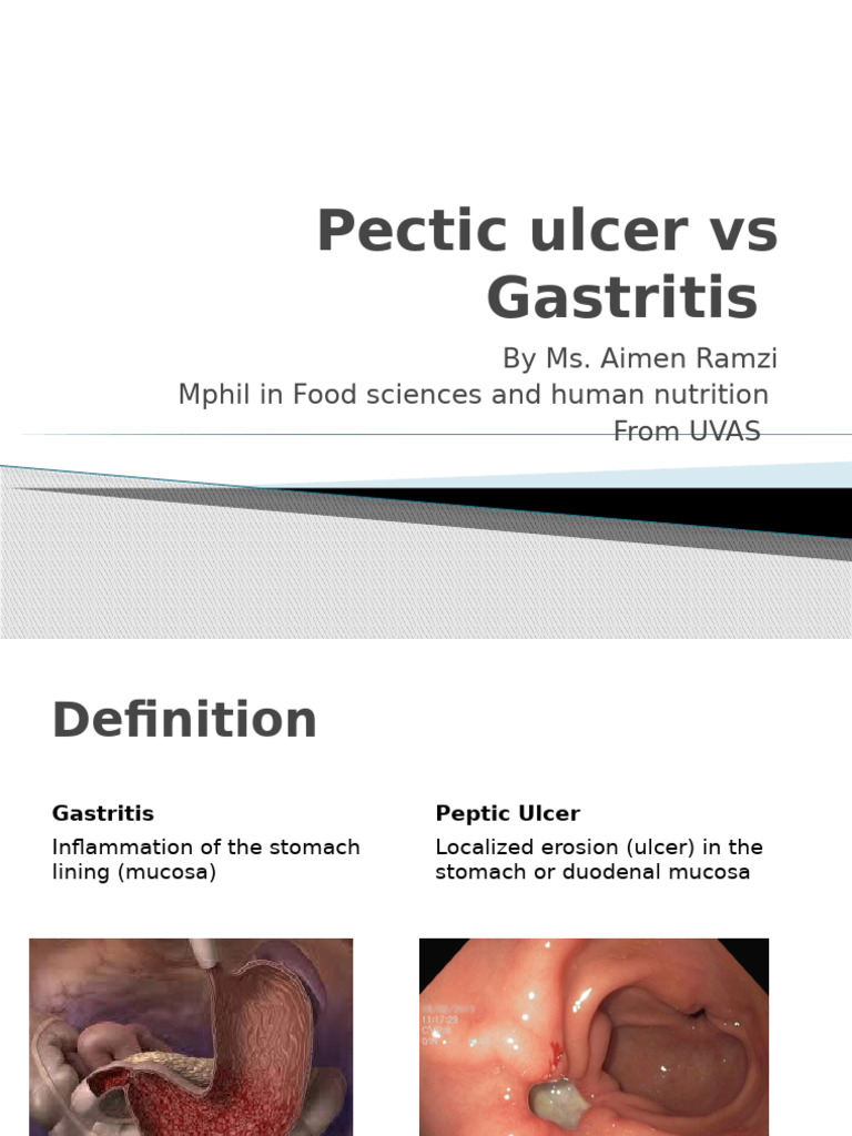 Gastritis vs Peptic Ulcer: Key Differences | PDF | Gastroenterology ...