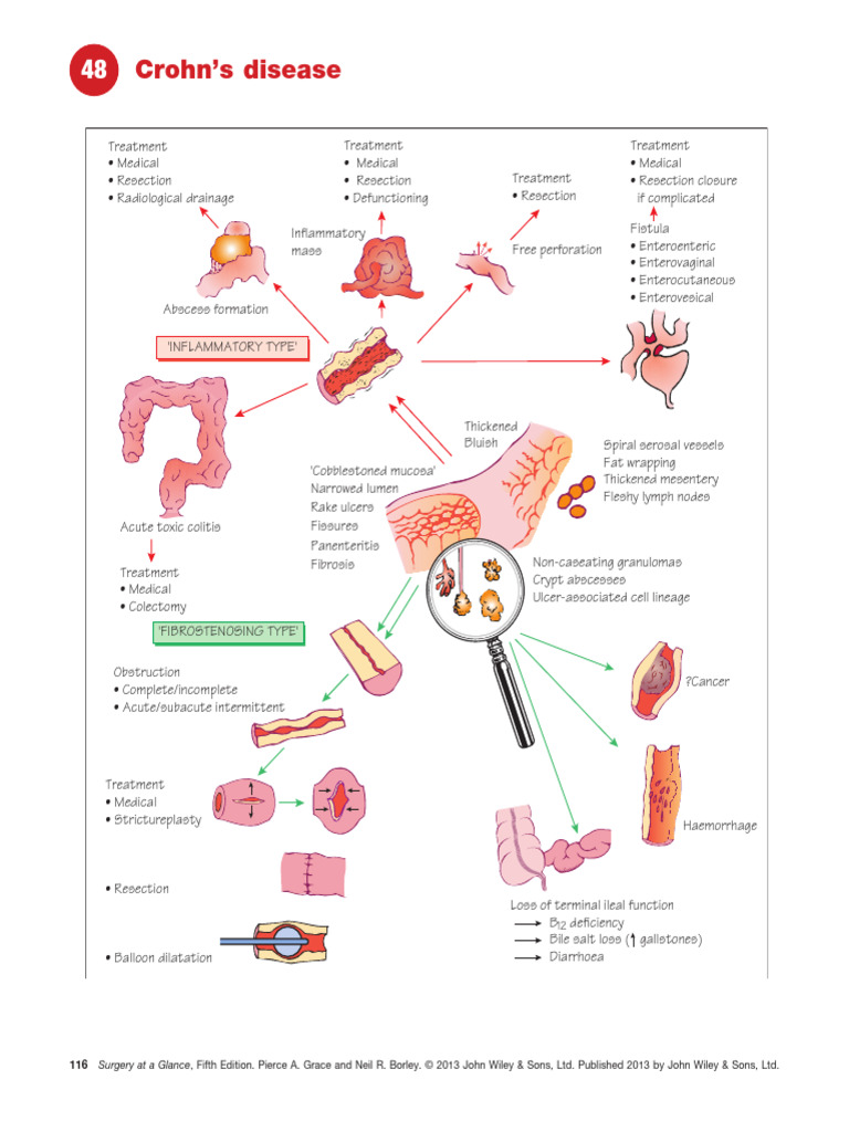 Overview of Crohn's Disease Management | PDF | Crohn's Disease ...
