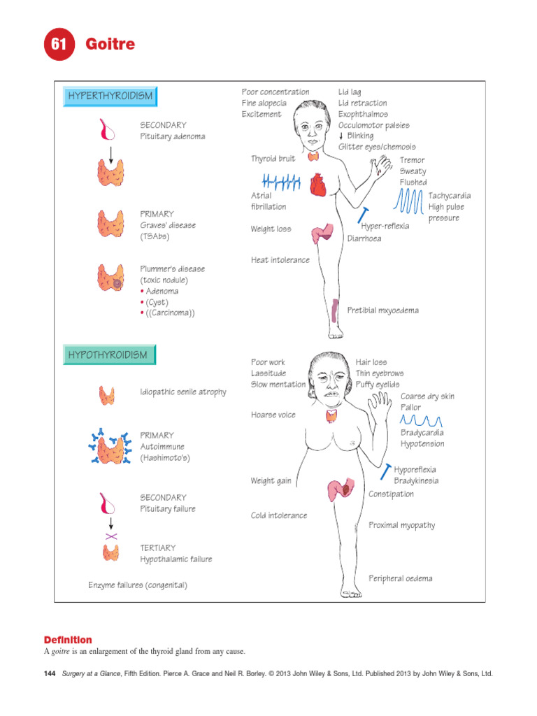 Goitre | PDF | Thyroid | Hyperthyroidism