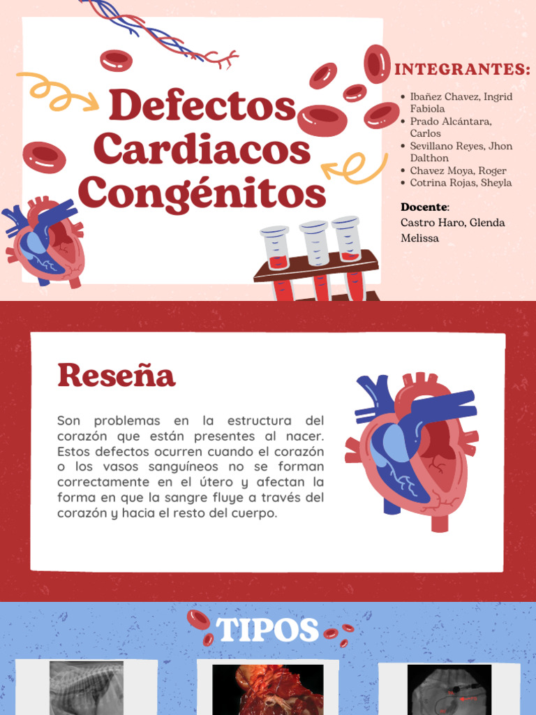 Defectos Cardiacos Congénitos | PDF | Corazón | Insuficiencia cardíaca
