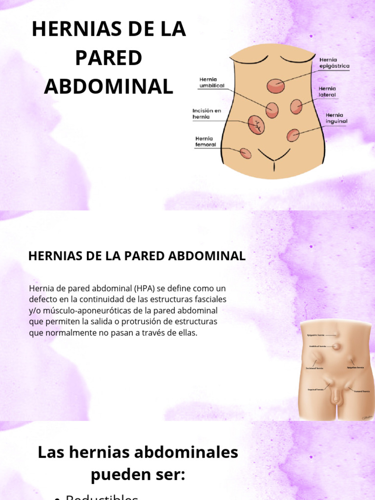 Hernias de La Pared Abdominal | PDF | Enfermedades y trastornos | Especialidades Medicas