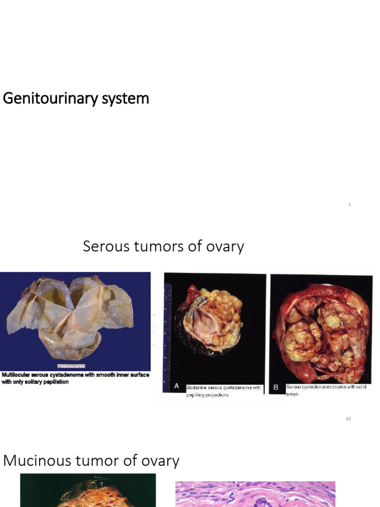 Genitourinary System | PDF