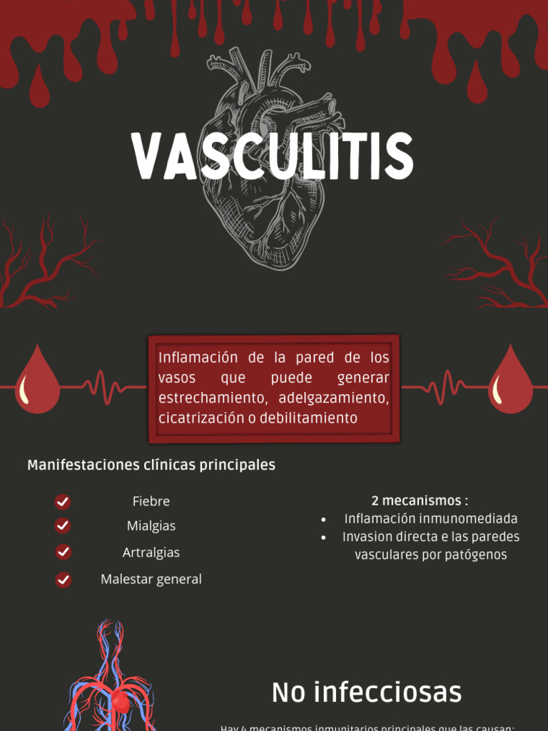 Vasculitis | PDF | Inflamación | Sistema inmune