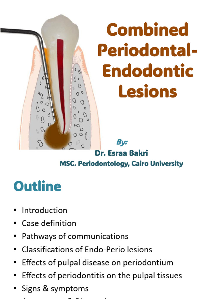 Endo Perio Interrelationship | PDF | Periodontology | Tooth