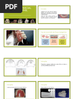 1 - Elementos Da PPR (Prótese Parcial Removível) | PDF | Prótese | Dente