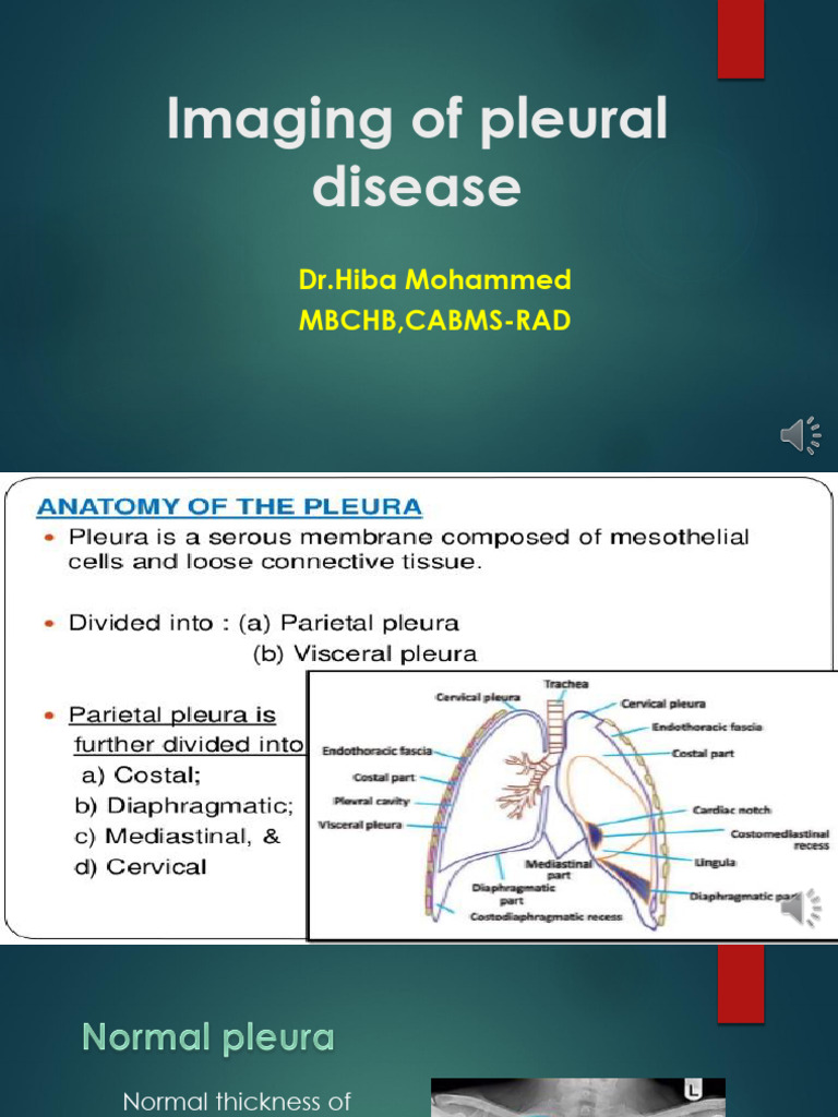 CT Scan Findings in Pleural Disease | PDF | Clinical Medicine | Thorax ...