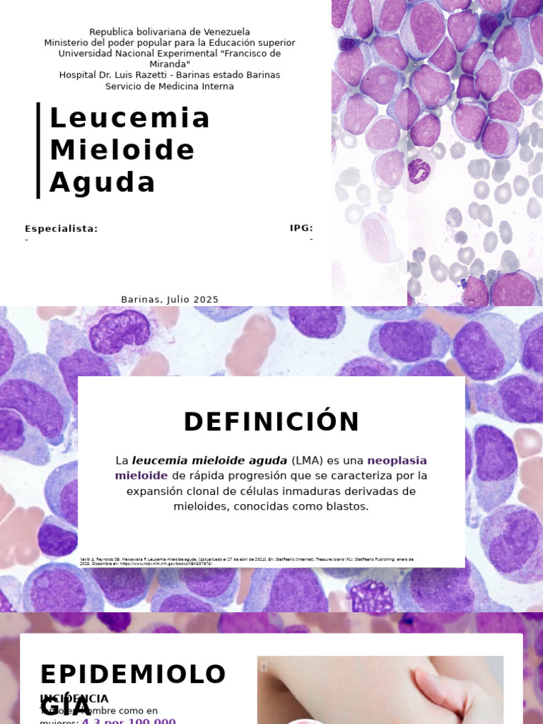 Leucemia Mieloide Aguda | PDF | Medicina CLINICA | Especialidades Medicas