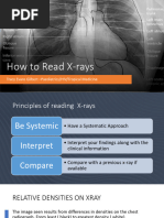 Costophrenic Angle Blunting Causes | PDF | Radiology | Lung