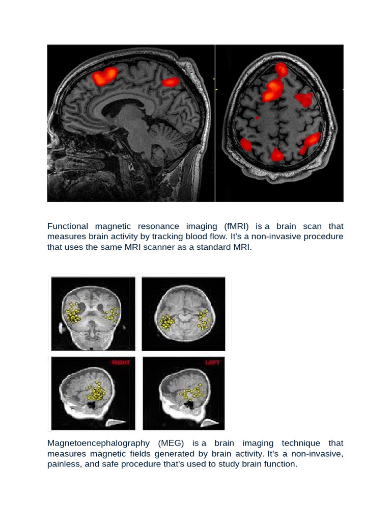 Brain Imaging Techniques Explained | PDF