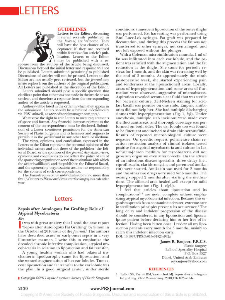 Myotomy of The Levator Labii Superioris Muscle And.50 | PDF | Botulinum ...