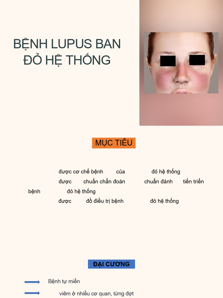 Benh Lupus Ban Do He Thong | PDF