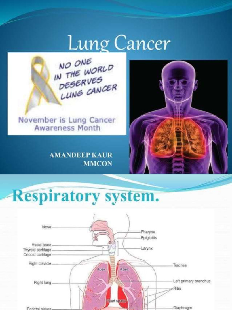 Lung Cancer | PDF