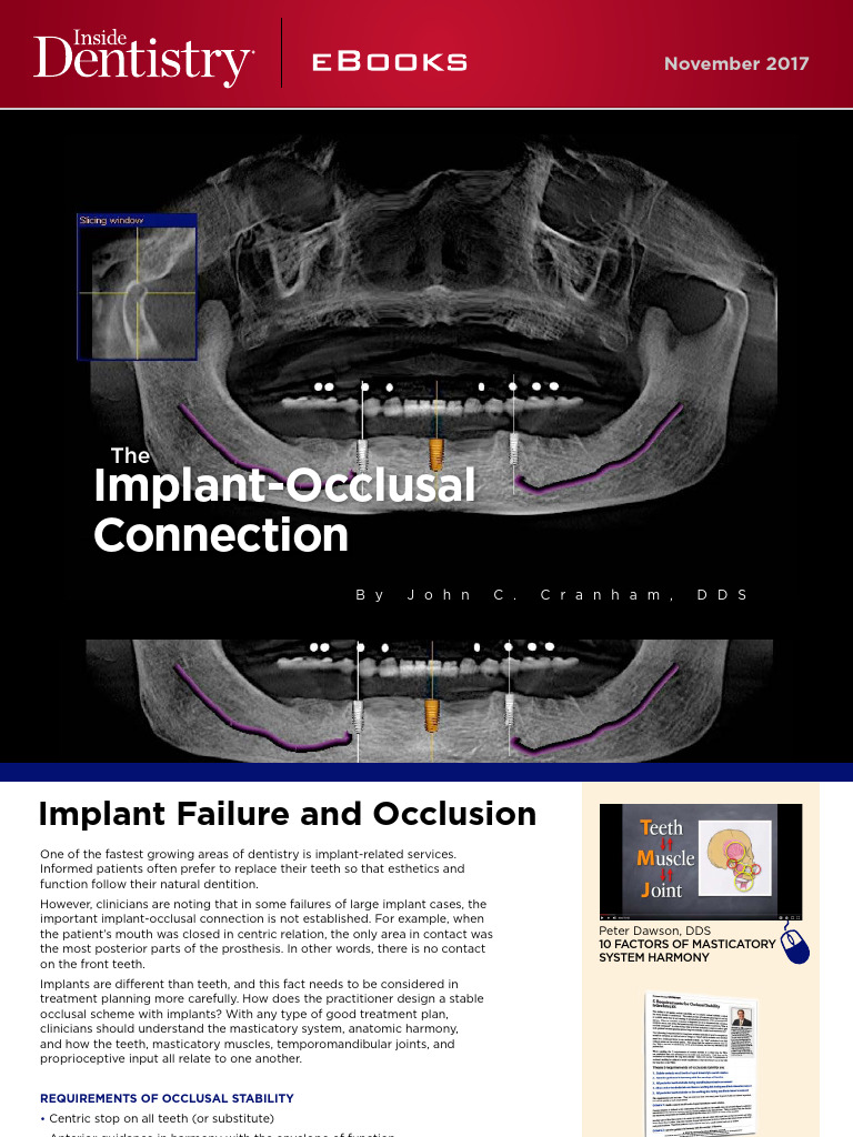 The Implant Occlusal Connection | PDF | Dental Implant | Dentistry Branches