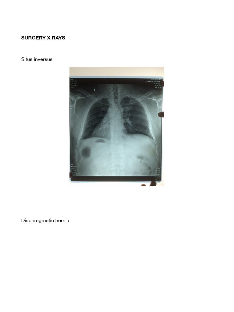 X-Ray Findings in Surgical Conditions | PDF
