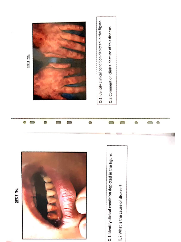 Biochemistry Spotting | PDF