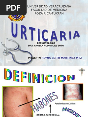 Urticaria Adrenergica
