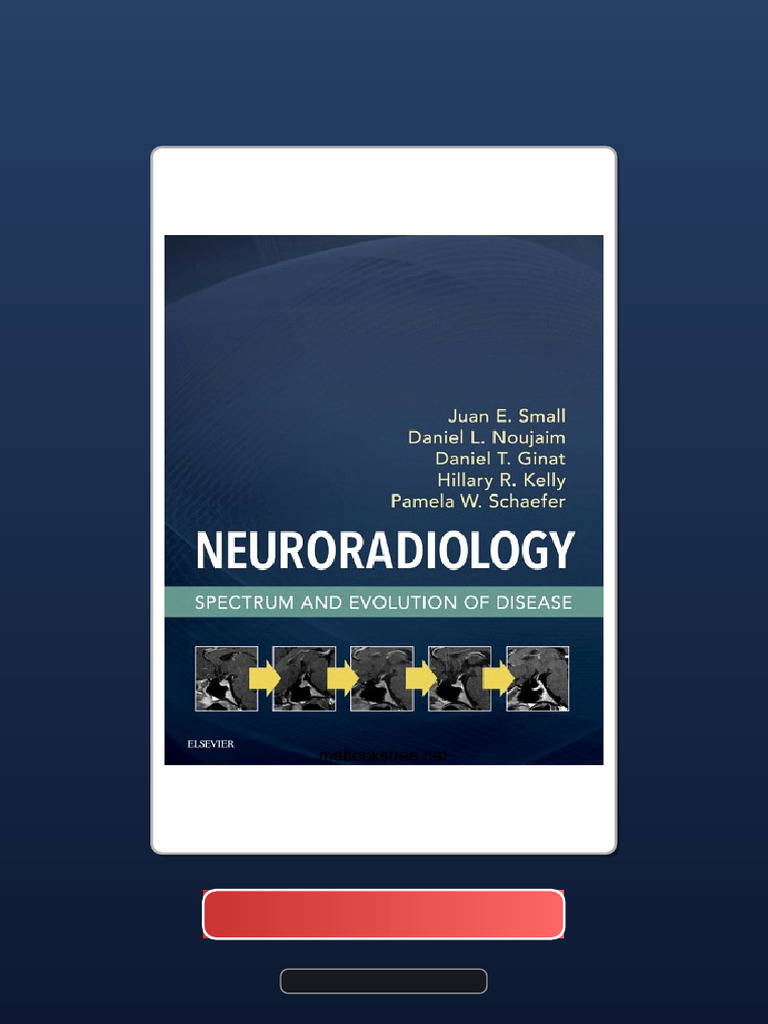Complete Bundle Neuroradiology Spectrum and Evolution of Disease 1st ...