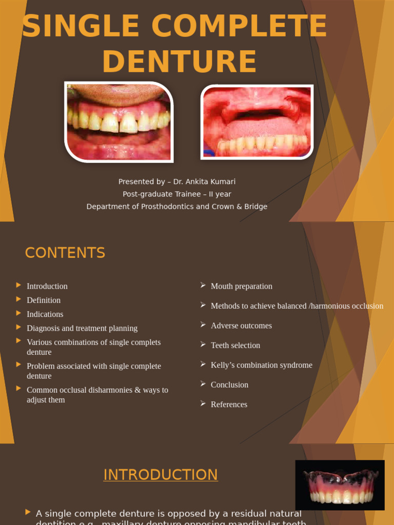 Single Complete Denture Overview | PDF | Dentures | Medical Specialties