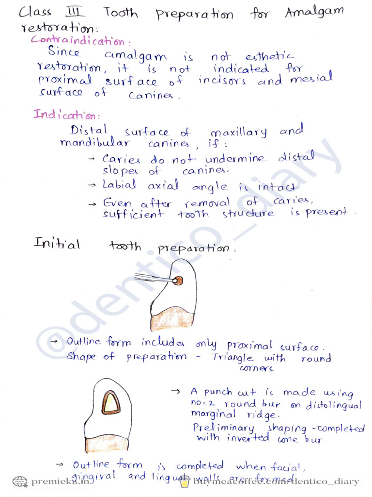 Class - III Tooth Preparation For Amalgam Restoration | PDF | Primate ...