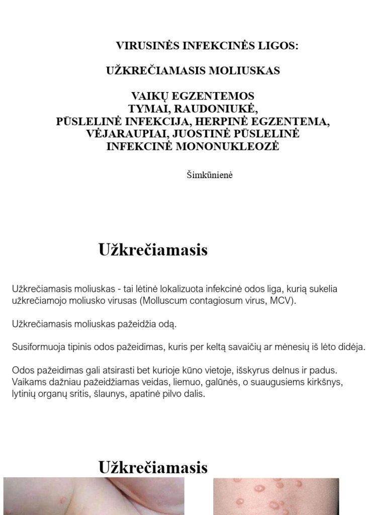 Virusines Infekcines Odos Ligos PDF | PDF