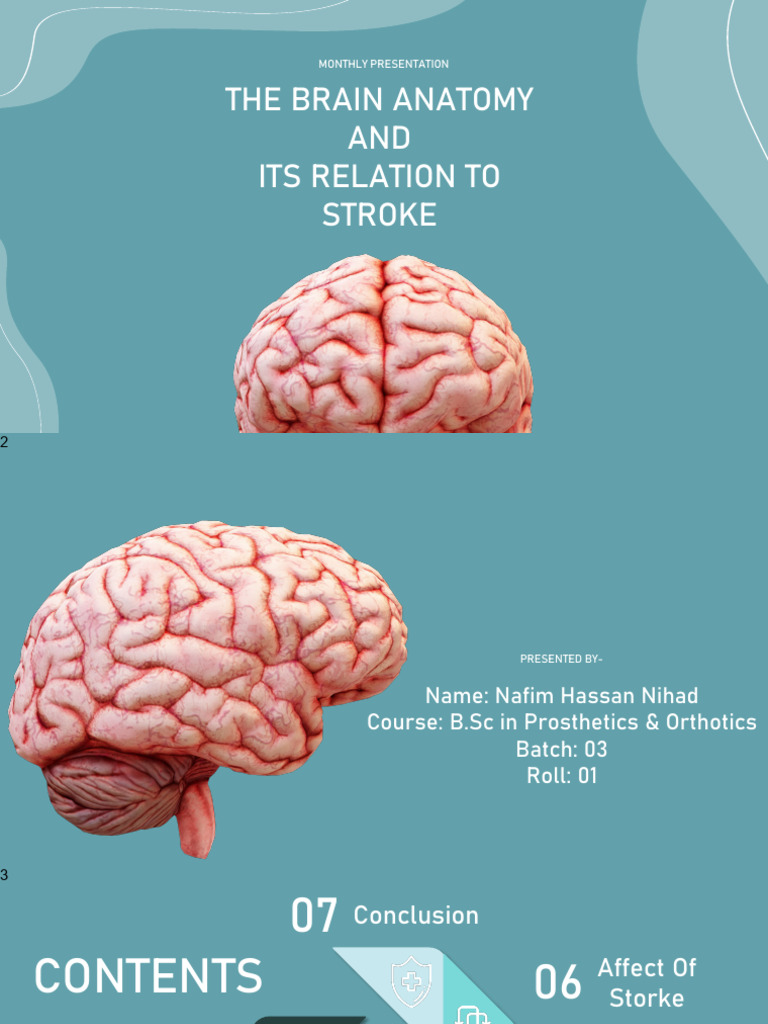 Brain Anatomy and Stroke Overview | PDF | Stroke | Cerebrum
