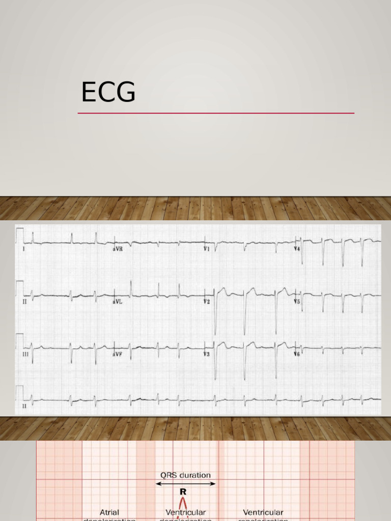 Abnormal ECG Report Analysis | PDF