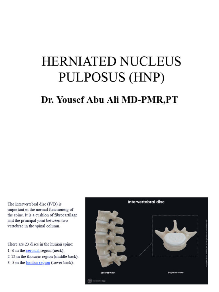 Herniated Nucleus Pulposus (HNP) | PDF | Vertebral Column ...