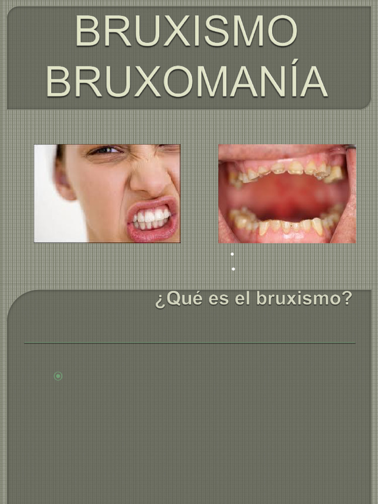 Tipos y Tratamientos del Bruxismo | PDF | Medicina CLINICA | Odontología