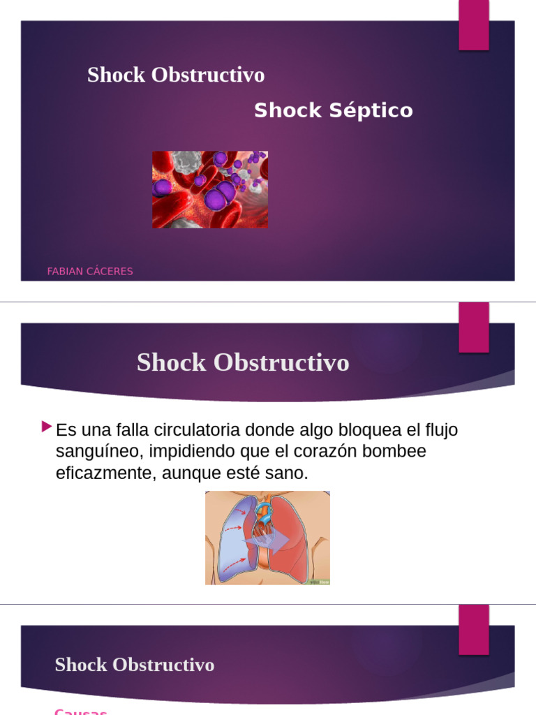 Shock Obstructivo-Exposicion | PDF