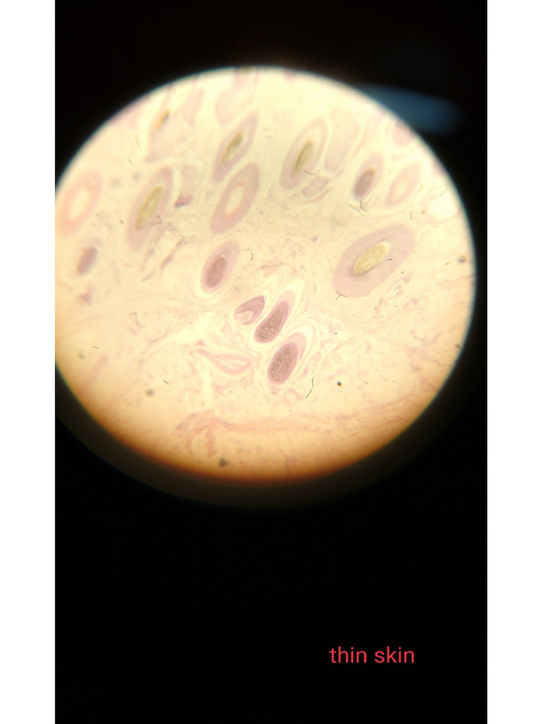 Histo Slides Revision 2 | PDF