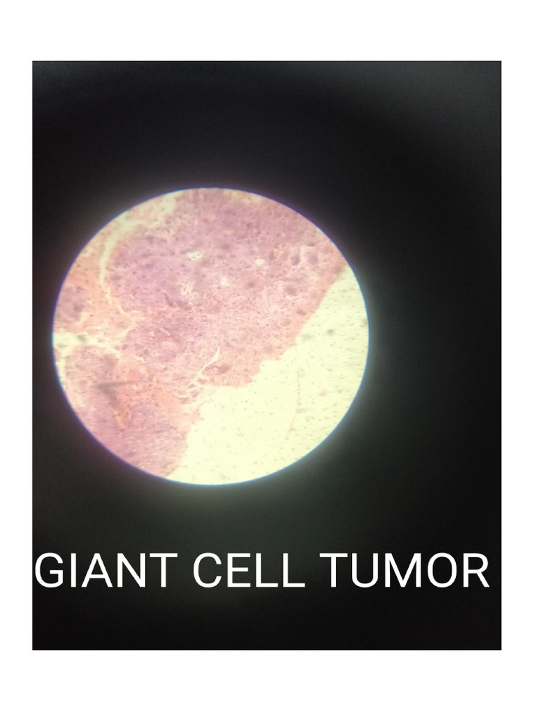 Pathology Practicals | PDF