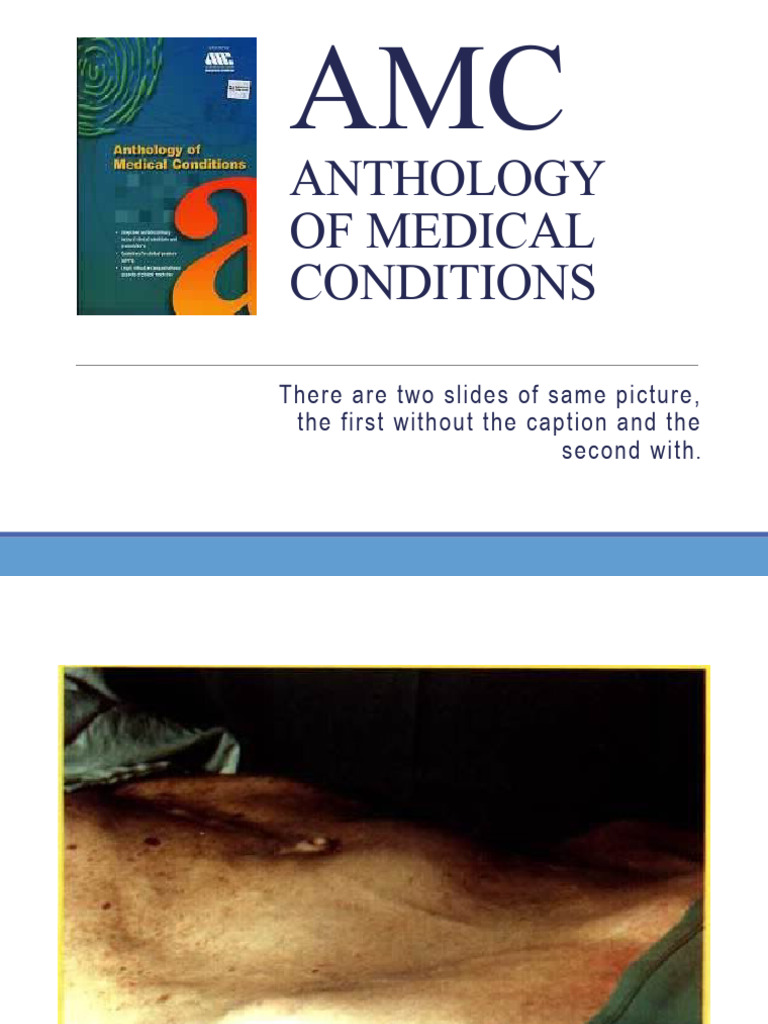 AMC Anthology of Medical Conditions | PDF