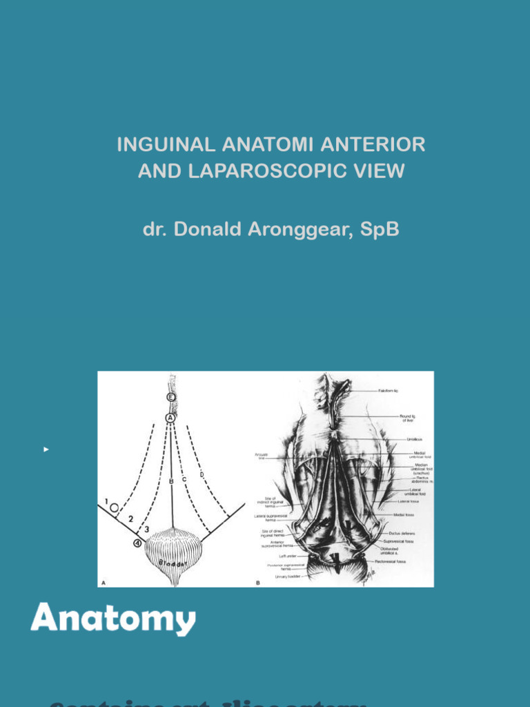 Inguinal Anatomi Anterior and Laparoscopic View | PDF
