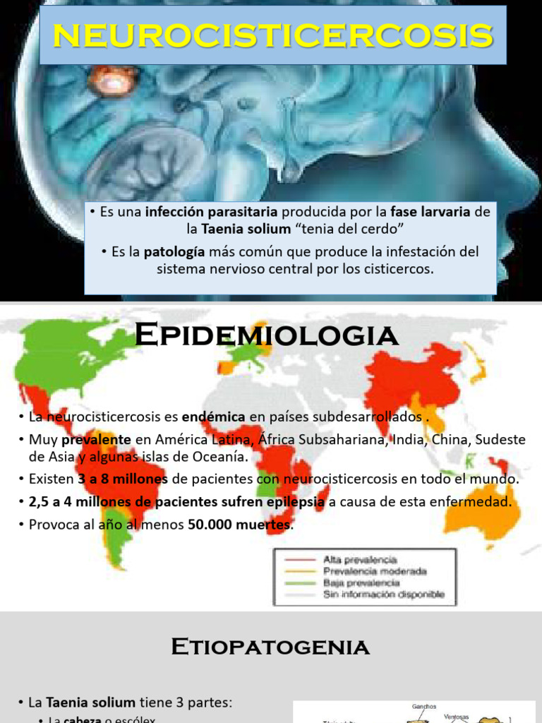 Neurocisticercosis: Diagnóstico y Tratamiento | PDF | Enfermedades y ...