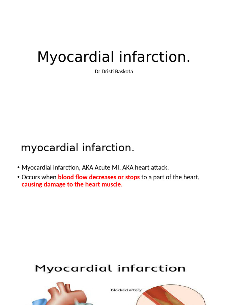 Understanding Myocardial Infarction Causes | PDF | Cholesterol | Low ...