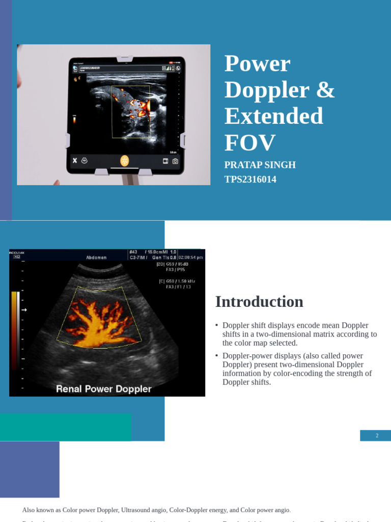 Power Doppler & Extended FOV Ultrasound | PDF | Doppler Effect | Color